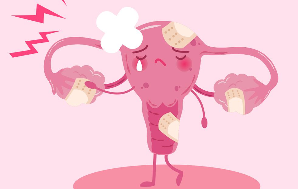 For Dummies: 5 need to know facts about Polycystic Ovaries (PCOS)